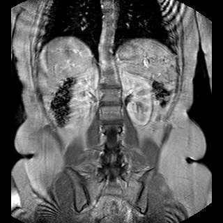 PREFERRED IMAGING CENTERS - Chicago IL - Hours, Directions, Reviews ...