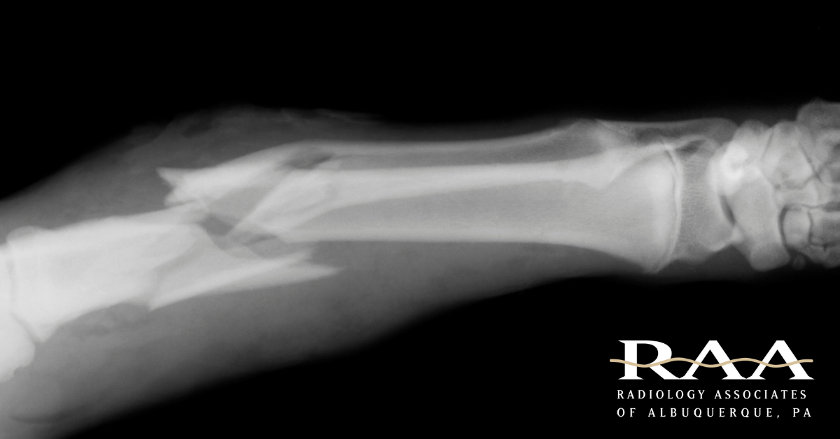 RAA IMAGING & HIGH RESOLUTION - Albuquerque NM - Hours, Directions ...