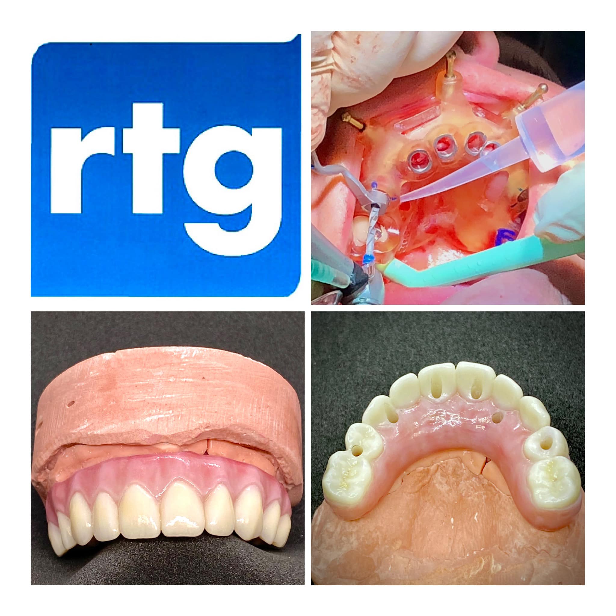 RTG DENTAL LAB - Rochester NY - Hours, Directions, Reviews - Loc8NearMe